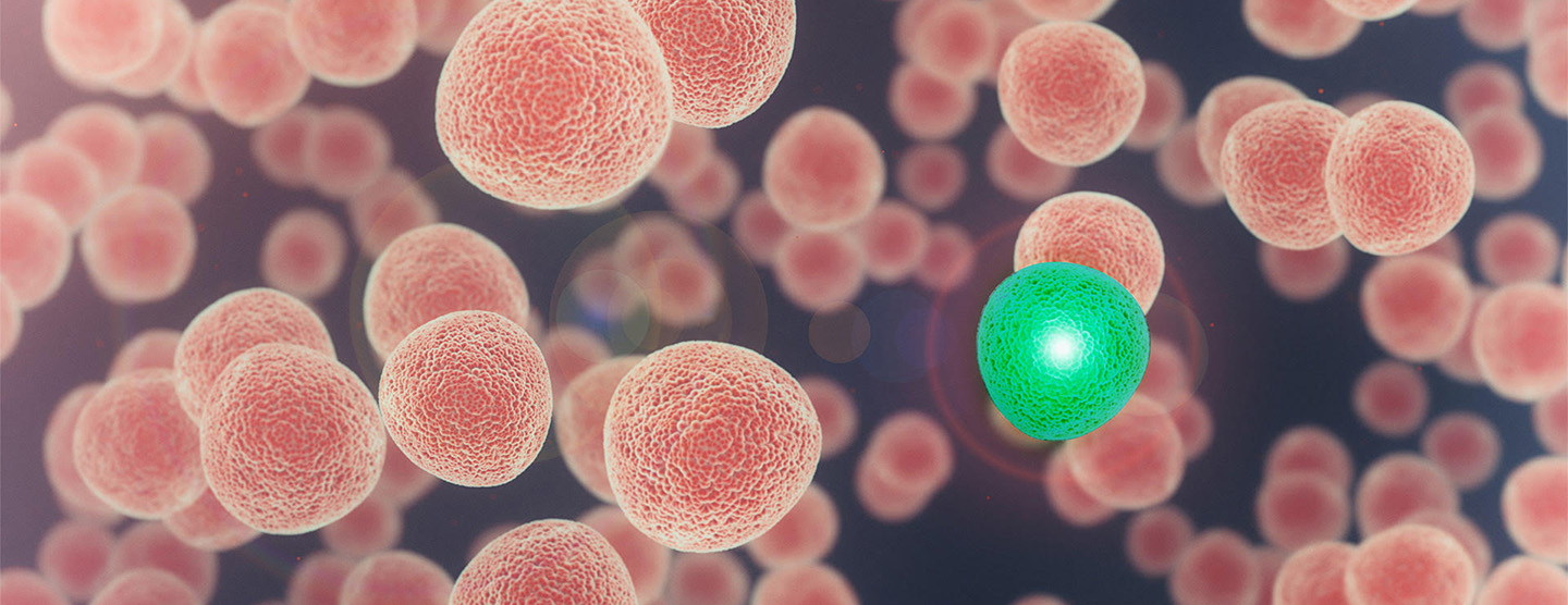 UCSF Cancer Center | Setting the pace in precision cancer therapies