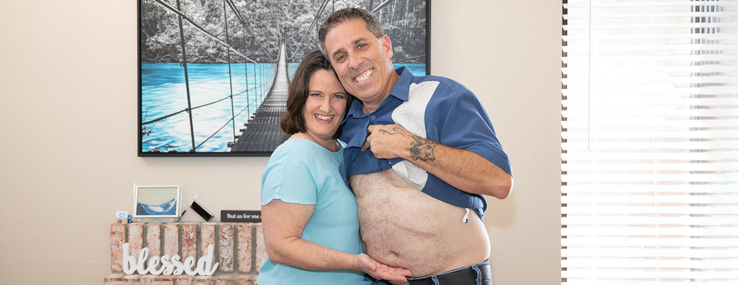 Living Organ Donors | UCSF Health