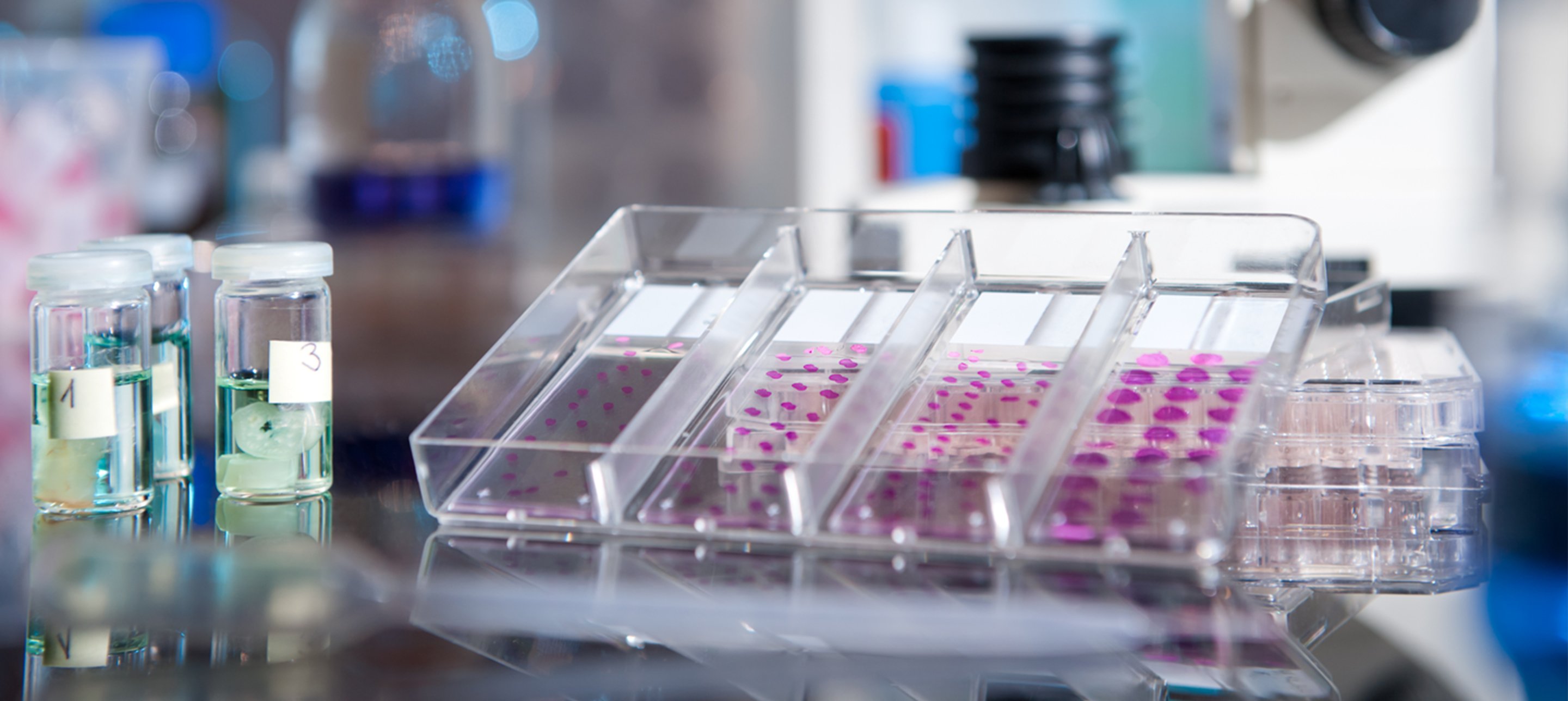 Biopsy for Breast Cancer Diagnosis: Magseed and Needle (Wire ...