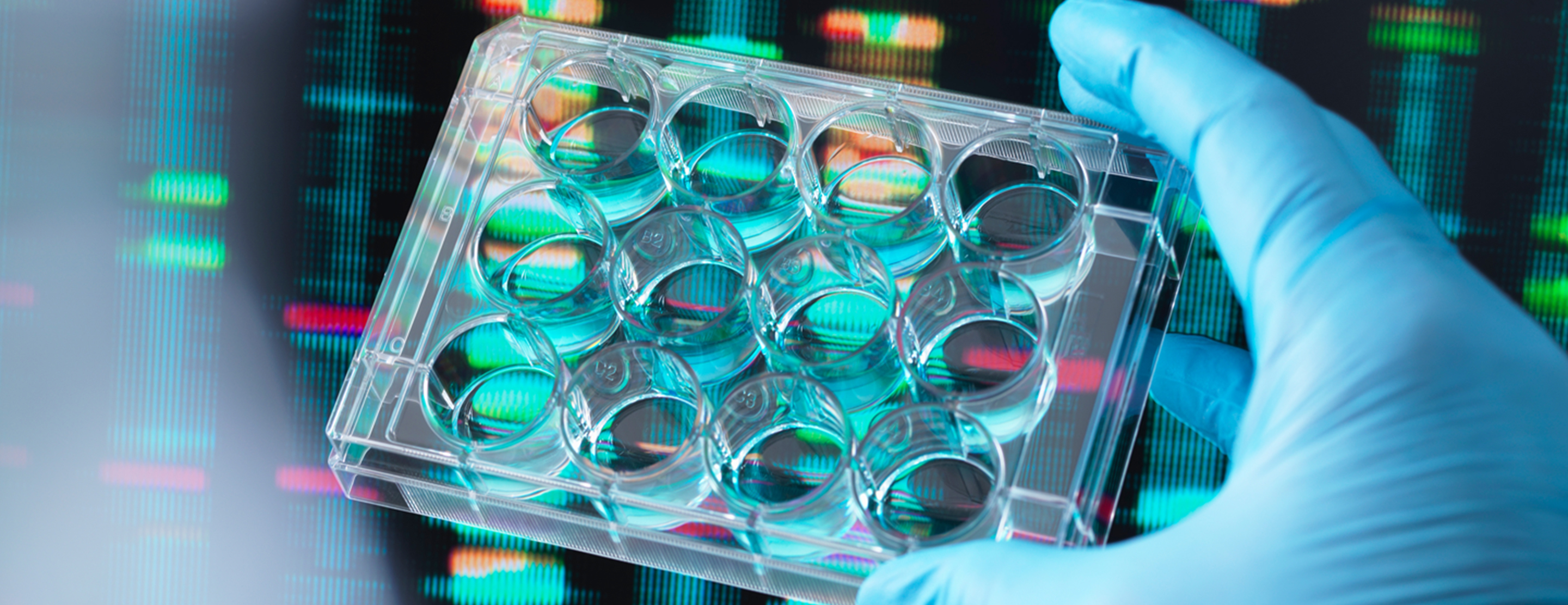 FAQ: Genetic Testing for Hereditary Cancer | UCSF Health