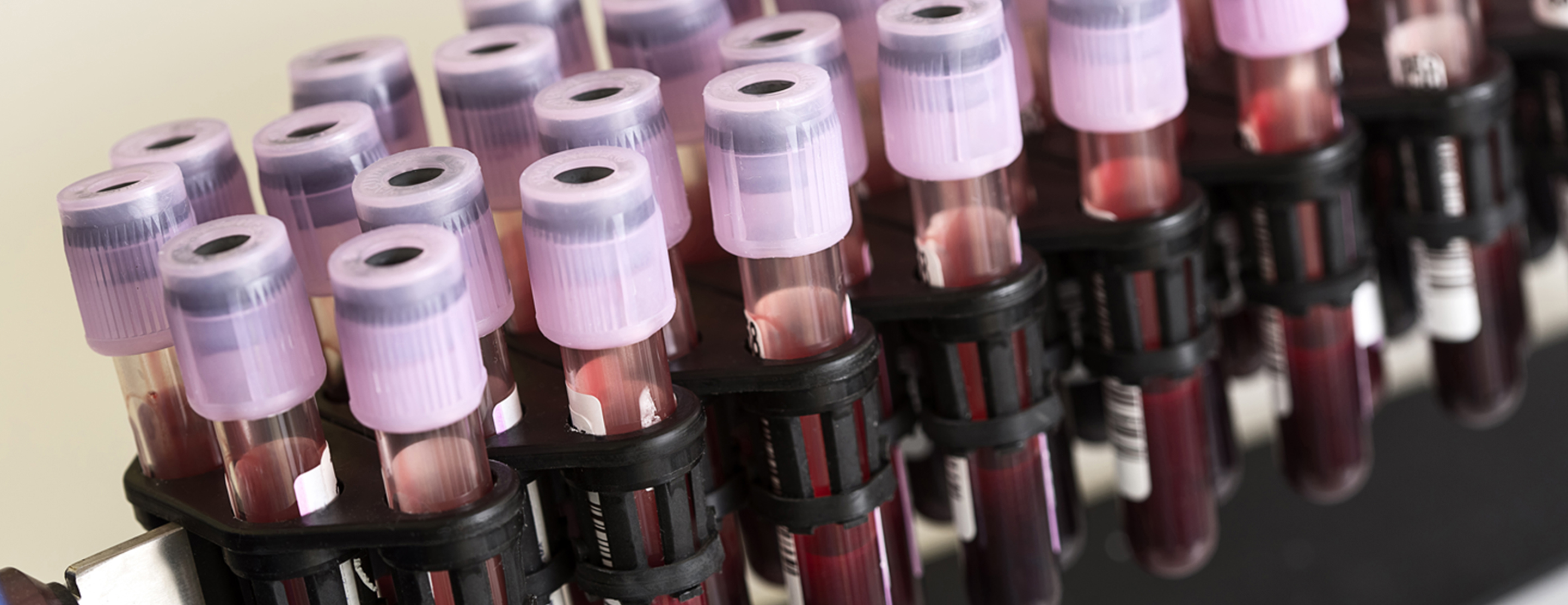 FAQ: Cell-Free DNA Screening | Patient Education | UCSF Health