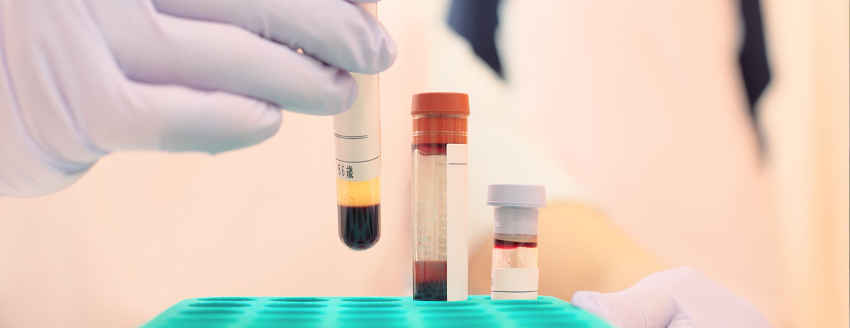 FAQ: Donating Blood | Patient Education | UCSF Health