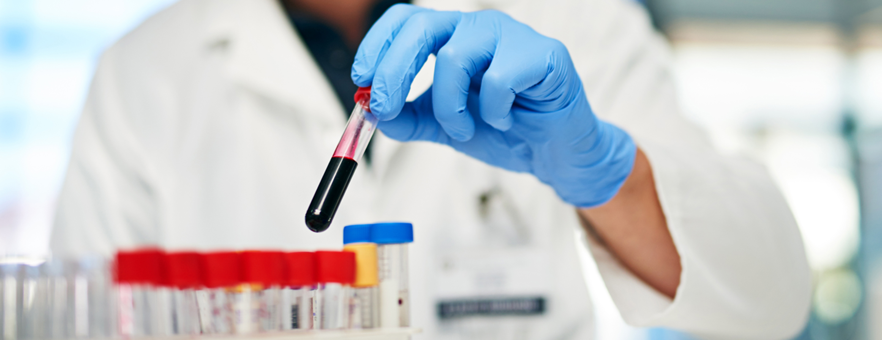 Digoxin Test