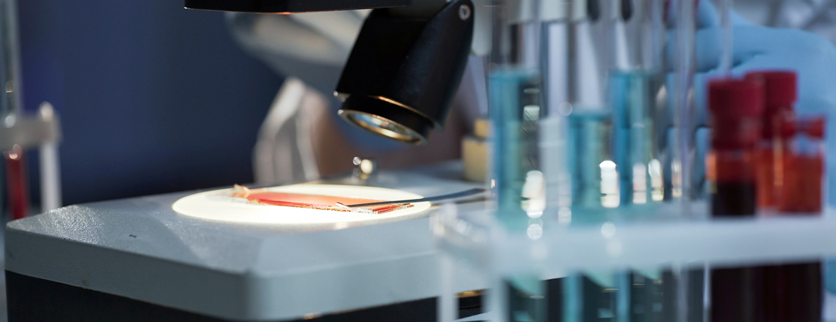 Microalbuminuria test