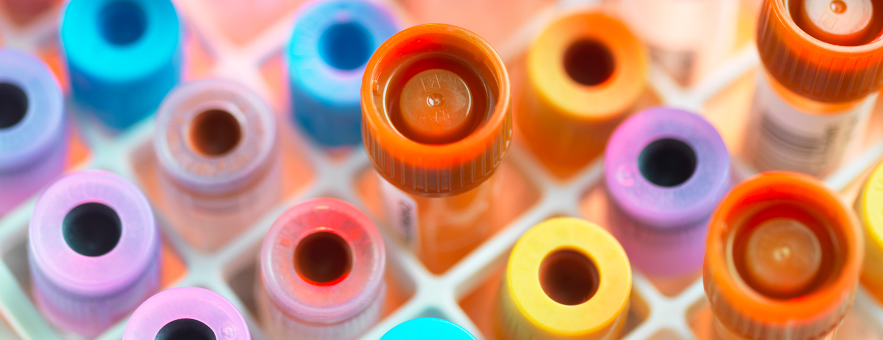 Reticulocyte Count