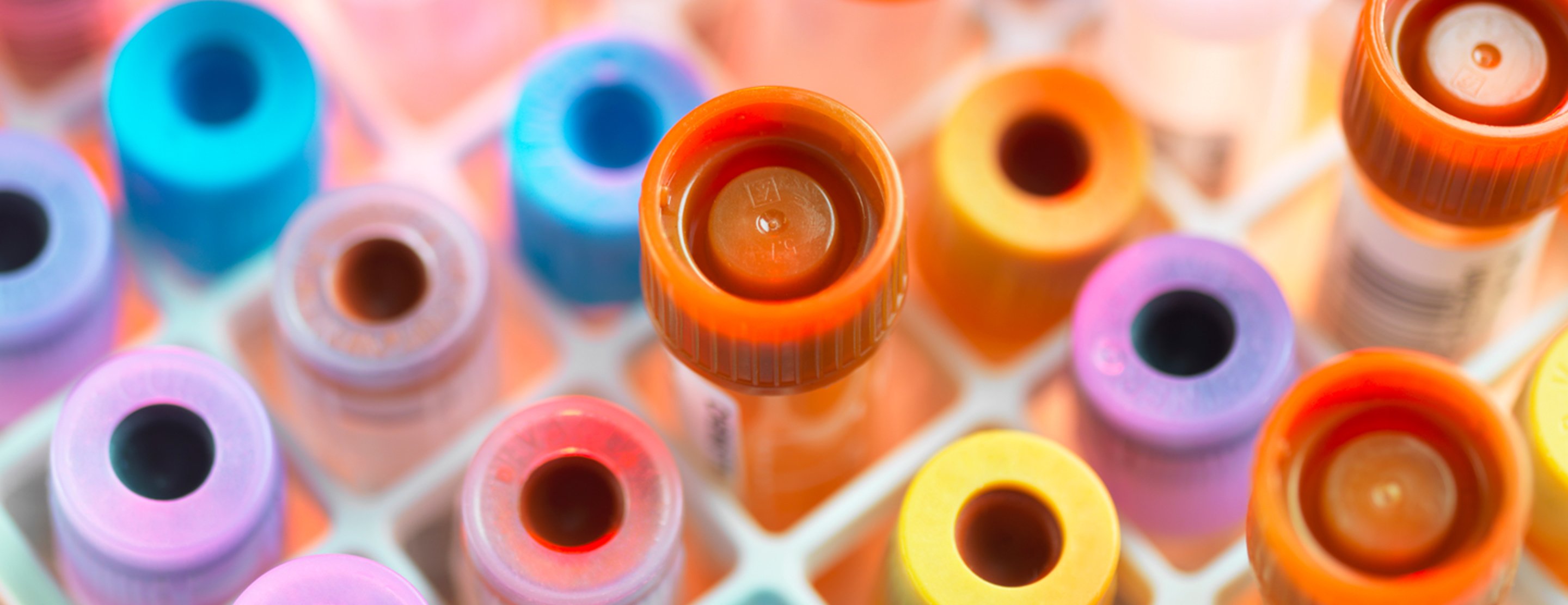 Serology for brucellosis