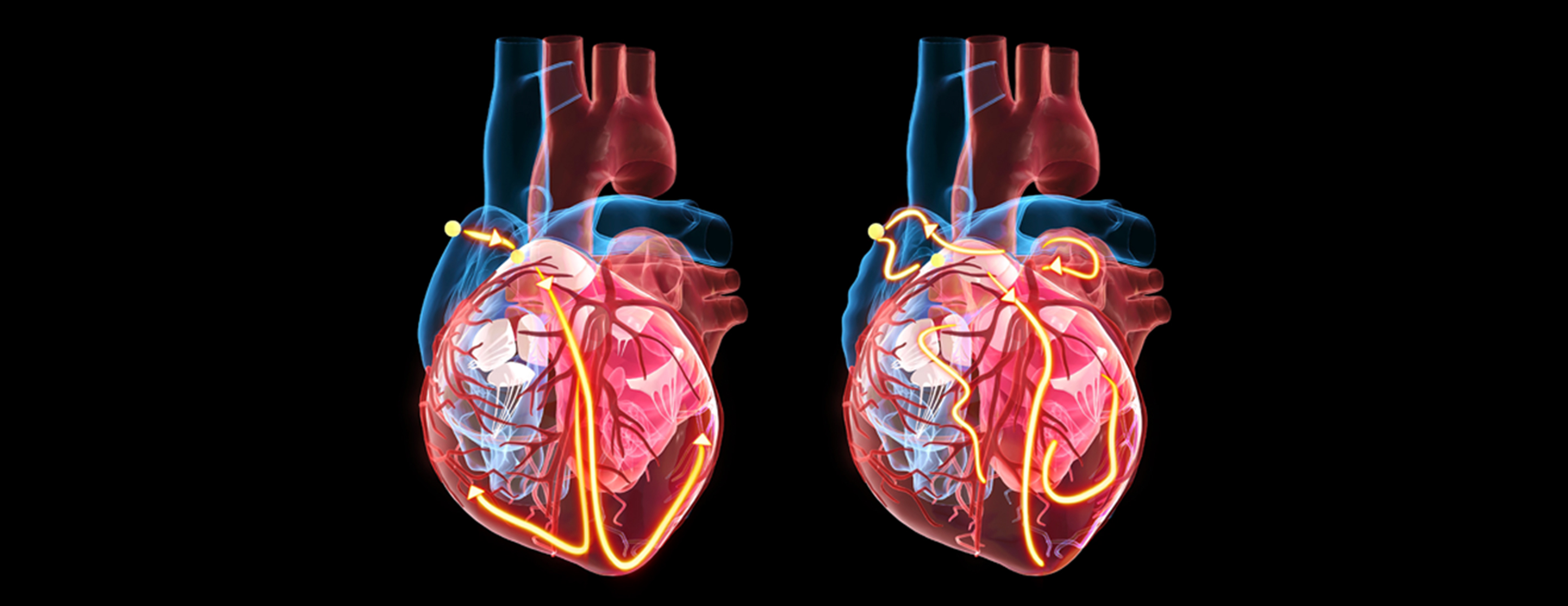 Cardioversion Side Effects