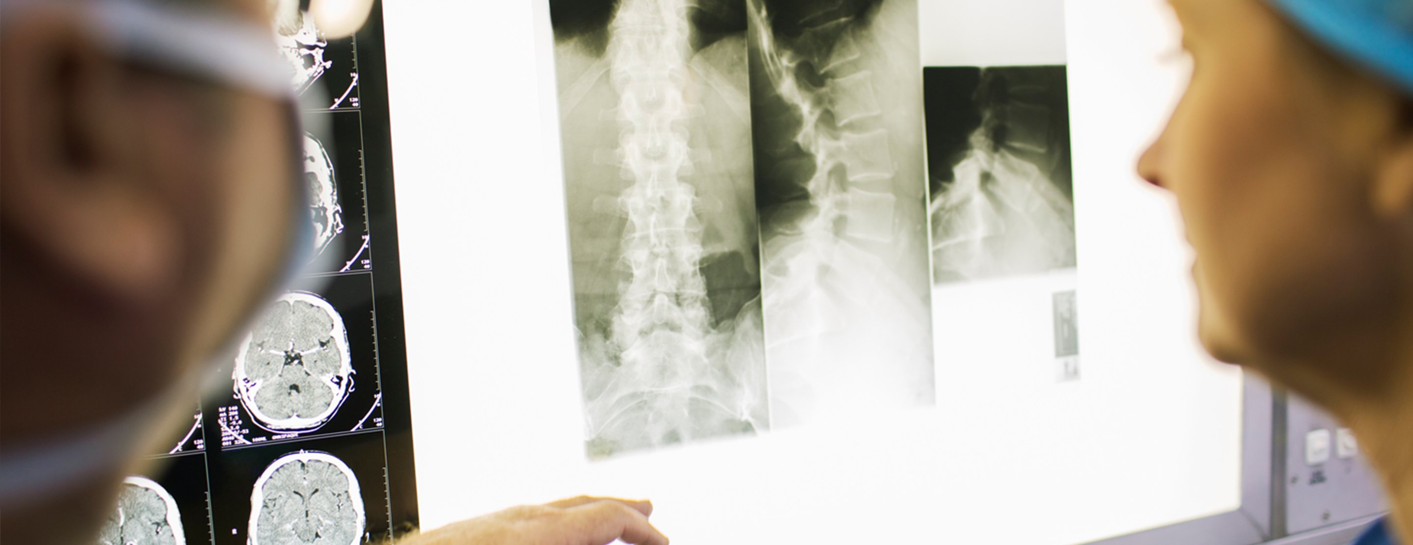 CT-Guided Spinal Injections | Conditions & Treatments | UCSF Health