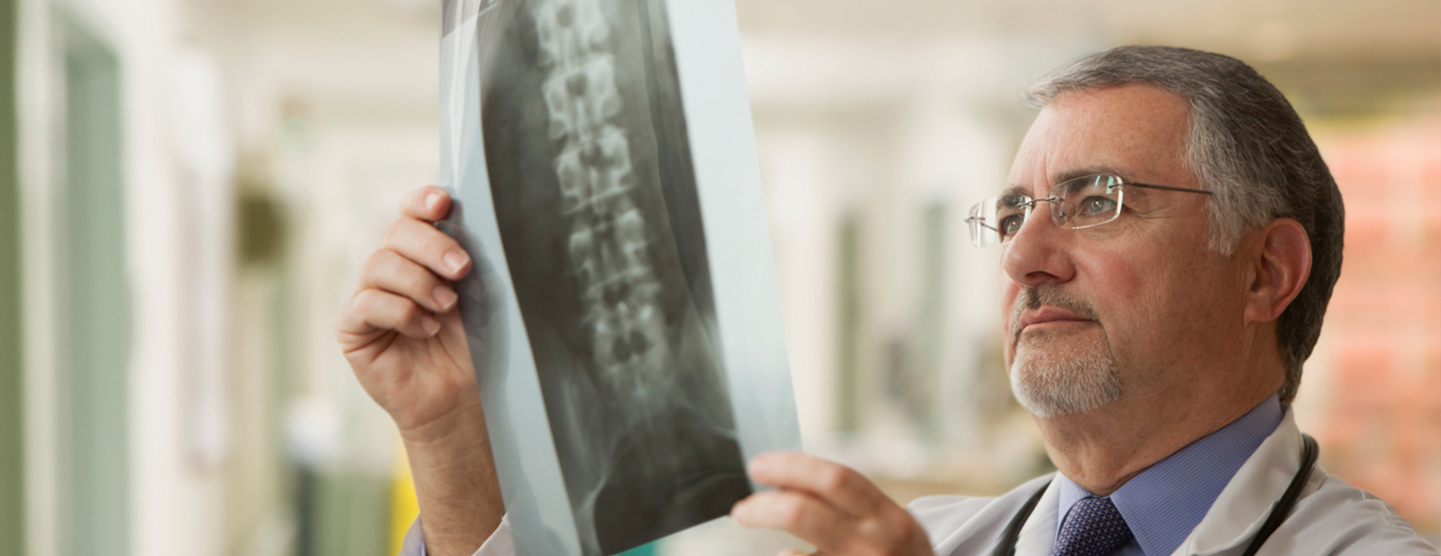 Extreme Lateral Interbody Fusion (XLIF) | Conditions & Treatments ...